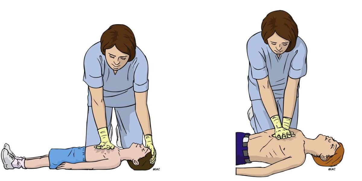 La Reanimación Cardiopulmonar Pediátrica evita paros ...